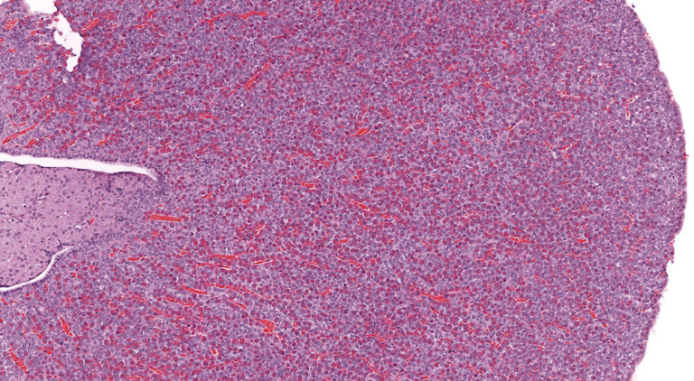Figures- Pathology of the Mouse - Pituitary Gland - Toxicologic Pathology