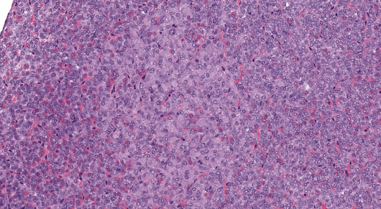 Figures- Pathology of the Mouse - Pituitary Gland - Toxicologic Pathology