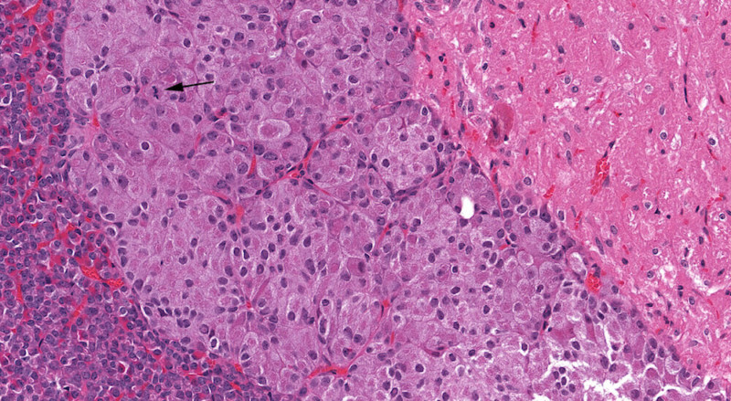 Figures- Pathology of the Mouse - Pituitary Gland - Toxicologic Pathology