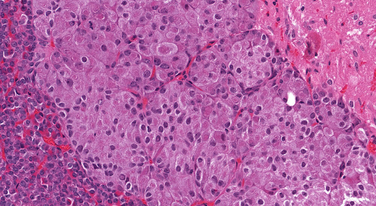 Figures- Pathology of the Mouse - Pituitary Gland - Toxicologic Pathology