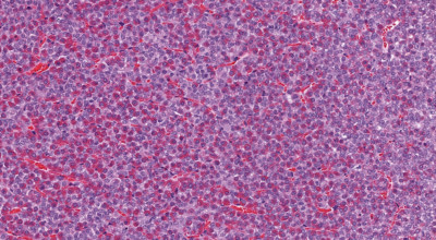 Figures- Pathology of the Mouse - Pituitary Gland - Toxicologic Pathology