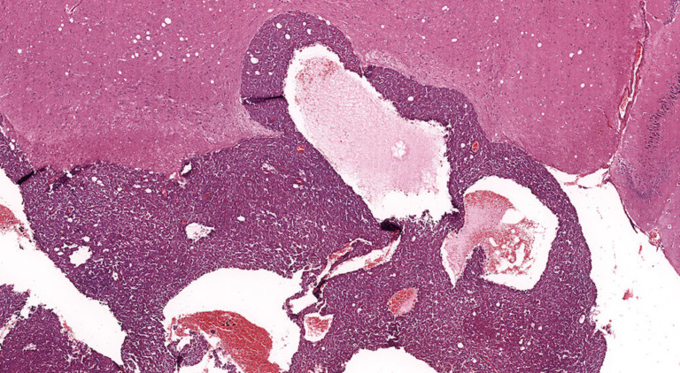 Figures- Pathology of the Mouse - Pituitary Gland - Toxicologic Pathology