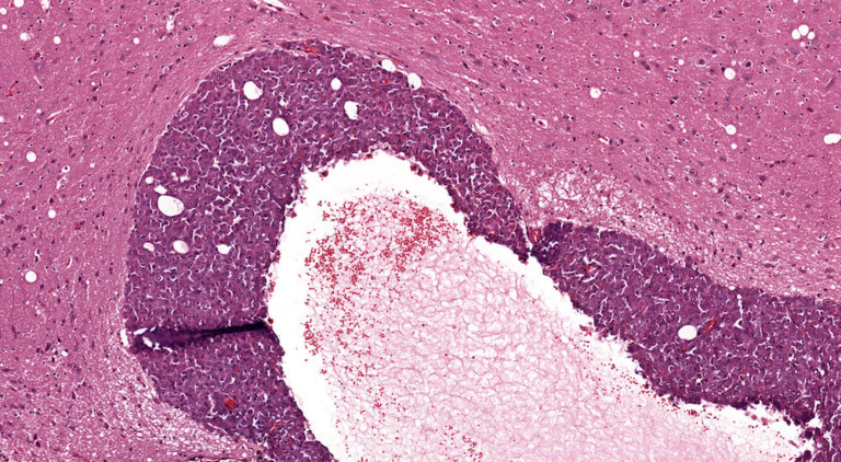 Figures- Pathology of the Mouse - Pituitary Gland - Toxicologic Pathology