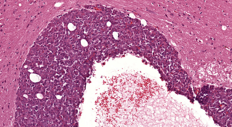 Figures- Pathology of the Mouse - Pituitary Gland - Toxicologic Pathology