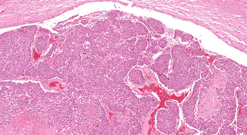Figures- Pathology of the Mouse - Pituitary Gland - Toxicologic Pathology