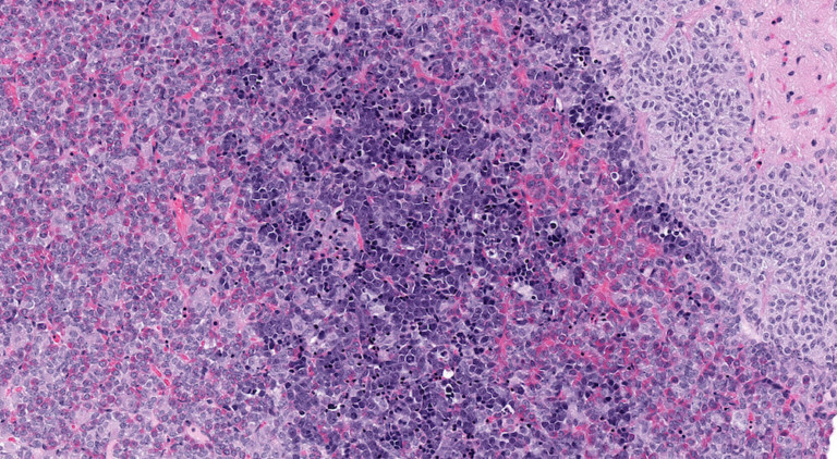 Figures- Pathology of the Mouse - Pituitary Gland - Toxicologic Pathology